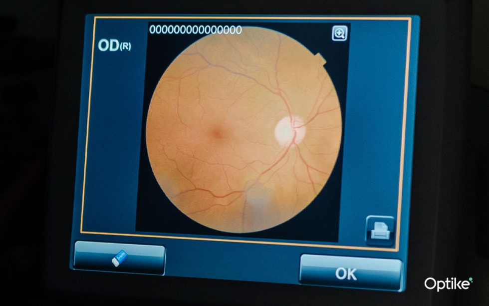 ¿Qué es la presión intraocular? | Optikè | Óptica en Tudela